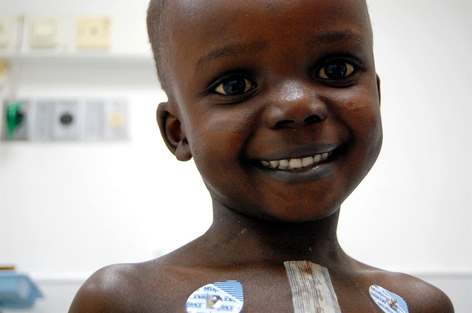 Save a Child’s Heart Funds Israeli Emergency Op for 4-Year-Old ...